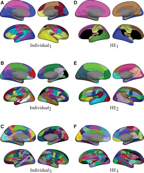 Optimizing Connectivity Driven Brain Parcellation Using Ensemble Clustering Brain Connectivity