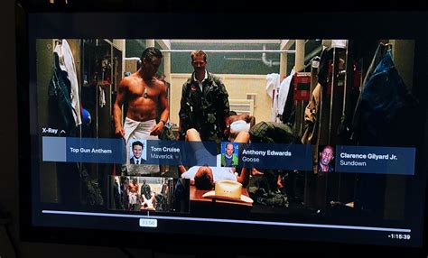 What Is X Ray On Amazon