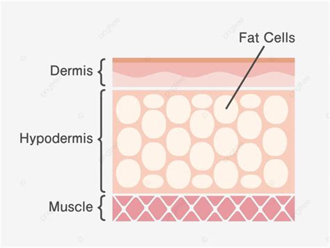 Sectional View Of Fat Cells Vector Illustration Recovery Cannula