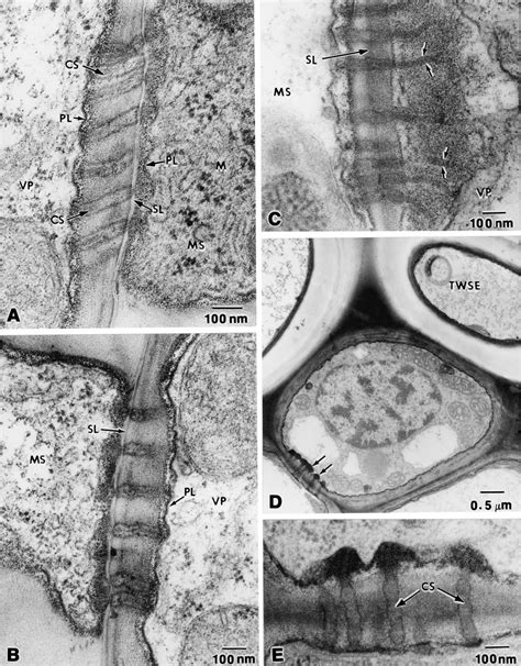 Figure 1 From Towards Reconciliation Of Structure With Function In Plasmodesmata Who Is The