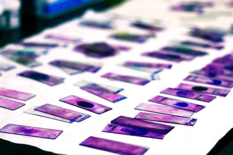 26 Facts About Staining