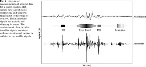 Diagram Of Accelerometric And Acoustic Data For A Single Swallow Ids Download Scientific