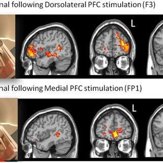 TMS Was Applied At Two Locations The DLPFC F Blue Circle And The Download Scientific