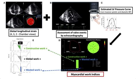 Methodology Of Myocardial Work Mw Assessment A Acquisition Of