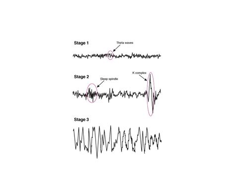 Image Nonrapid Eye Movement Nrem Eeg Msd Manual Professional Edition
