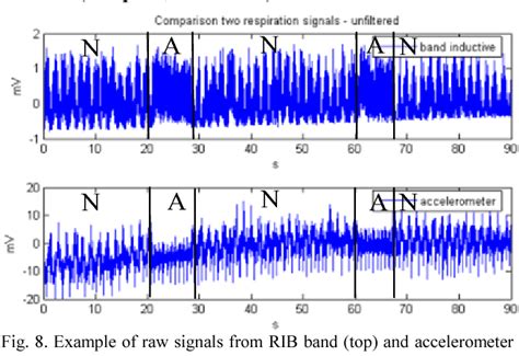 Figure 1 From Estimation Of Respiratory Waveform And Heart Rate Using