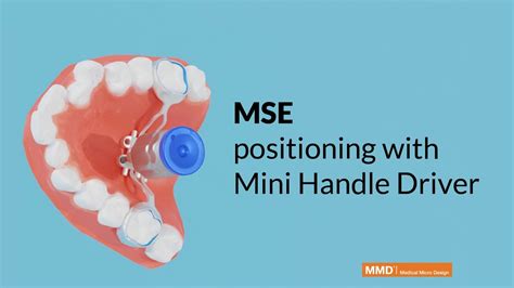 Palatal Expander Mse Maxillary Skeletal Expander Positioning On