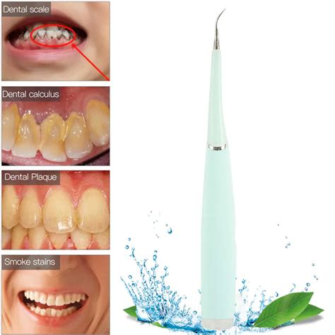 Электрическая звуковая зубная скалер зубной камень калькулятор Вибрация отбеливание зубов