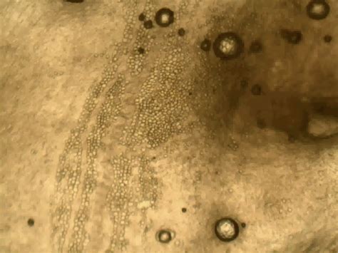 Fascia And Extra Cellular Matrix Ecm Defining Fascia