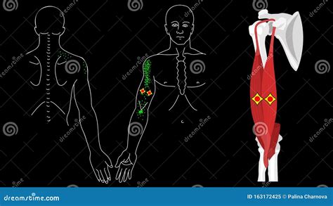 Musculus Biceps Brachii Biceps Trigger Points And Pain Stock Illustration Illustration Of