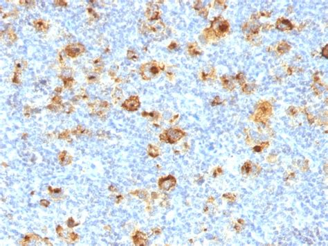 Cd15 Fut4 Reed Sternberg Cell Marker Antibody Clone My 1 Gene Id 2526
