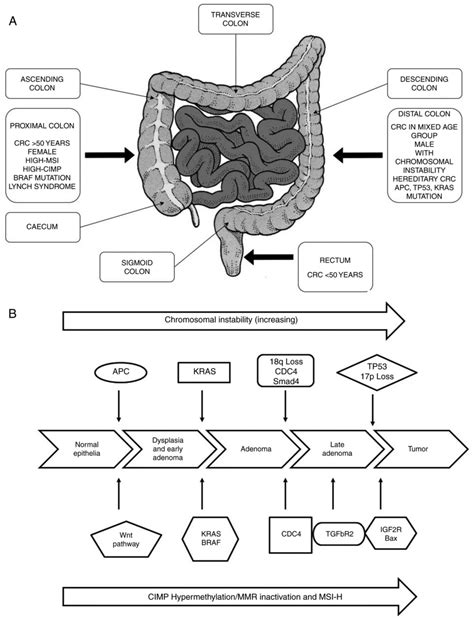 Where Do Colorectal Cancers Come From Colorectal Cancer Incidence