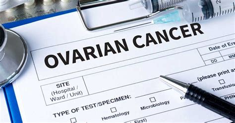 Ovarian Cancer Risk Factors And Prevention Health365 Sg