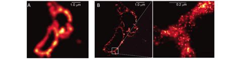 Fluorescence Photoactivated Localization Microscopy A Total Internal