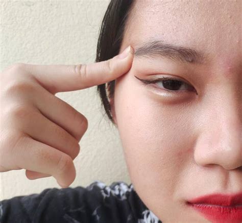 800개 이상의 기계적 여드름 이미지 스톡 사진 그림 및 Royalty Free 이미지 Istock