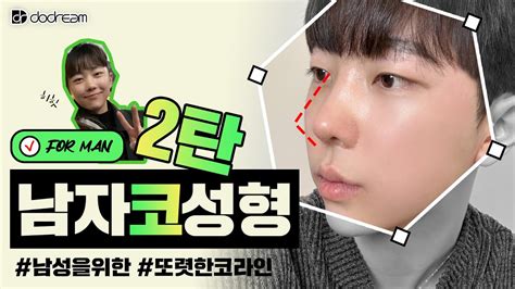 두드림tv 티 안나게 자연스러운 무보형물 코성형 2탄💚 코성형 Vlog Youtube