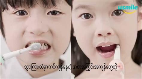 သွားပိုးစားခြင်းမှ ကင်းဝေးစေဖို့ လျှပ်စစ်သွားတိုက်တံ သုံးကြစို့ 🦷🦷 Usmilemyanmar