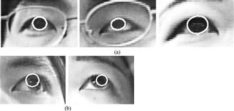 a b correct and false pupil localization results respectively [49