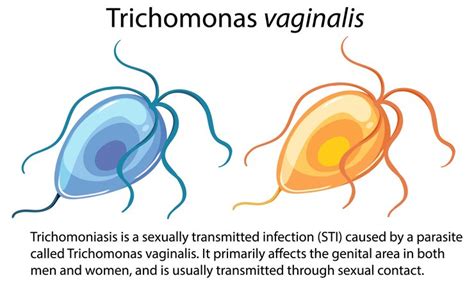 Free Vector Trichomonas Vaginalis With Explanation