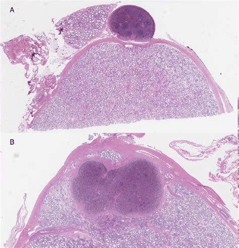 Microscopic Appearances Of Left Testicle Demonstrating A Ectopic Download Scientific Diagram