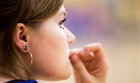 C Mo Curar Un Padrastro Cortaporlosano