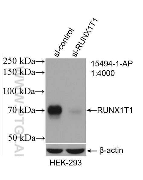 Runx1t1 Antibody 15494 1 Ap Proteintech