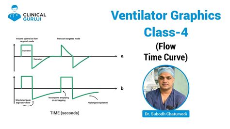 Ventilator Graphics Class 4 Flow Time Curve Youtube