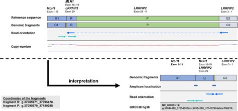 Using Whole Genome Sequencing To Identify A Complex Structural Variant