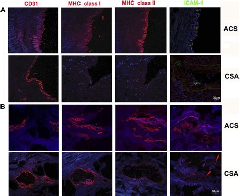 Confocal Microscopy Of Major Histocompatibility Complex Mhc Class I Download Scientific