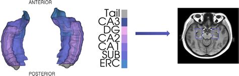 3d Segmentation Of Hippocampal Subfields Using Ashs On A Random