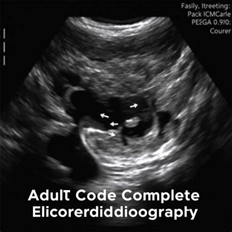 Cpt Code For Adult Complete Echocardiogram And Cost Of Amalgam Fillings Wmwtl