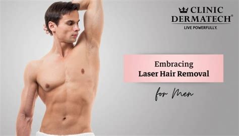Embracing Laser Hair Removal For Men Skin And Hair Care Tips Clinic