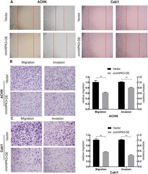 Overexpression Of Circhipk3 Inhibits Invasion And Metastasis Of Ccrcc
