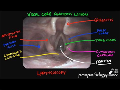 Vocal Chord Anatomy Vocal Cord Injury Ep Chiropractic Injury