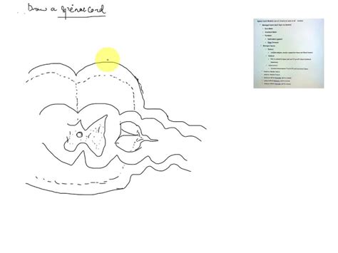 Solved Spinal Cord Models Not All Structures Seen On All Models Meningeal Layers Each Layer