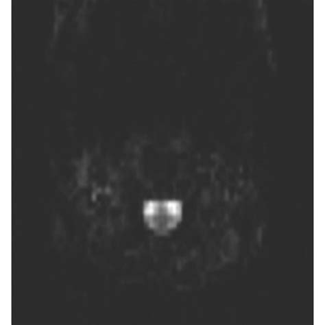 Example Of Functional Magnetic Resonance Imaging Fmri In Different