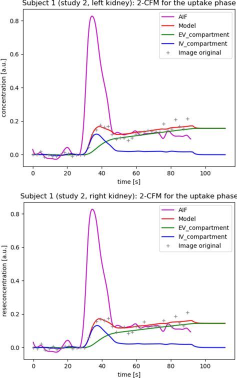 Figure 3 From Automated Determination Of Arterial Input Function In Dce