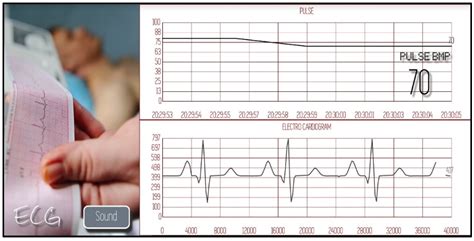 A Solution For Optimizing The Development Of Embedded Graphical User Interfaces