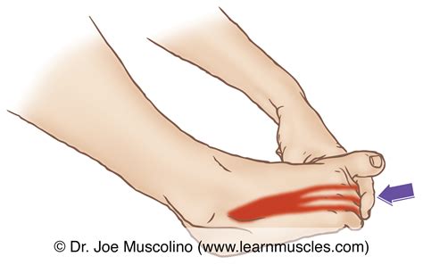 Extensor Tendonitis Exercises Pdf At Samantha Tennant Blog
