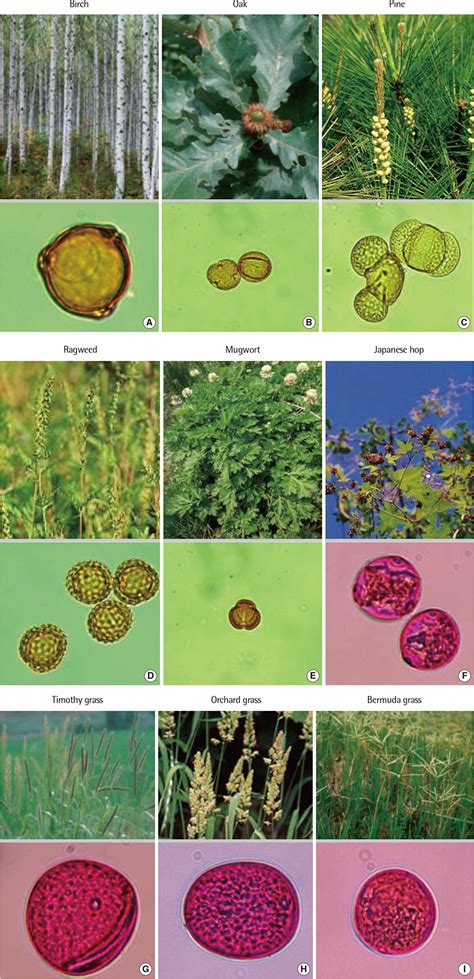 꽃가루 생태변화와 소아청소년 알레르기비염에 관한 고찰