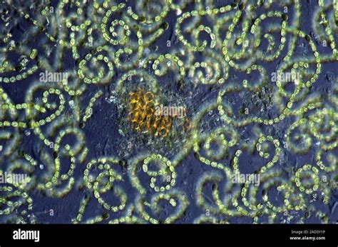 Anabaena Cyanobacteria Polarised Light Micrograph Of Filamentous Colonies Of Anabaena Sp