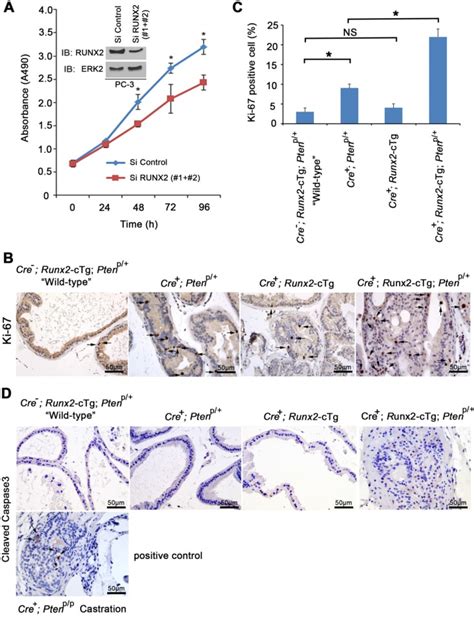 Runx2 Overexpression And Pten Haploinsufficiency Cooperate To Promote