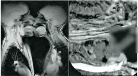 Ini Hasil Pindaian MRI Tubuh Saat Berhubungan Seks Health Liputan6 Com