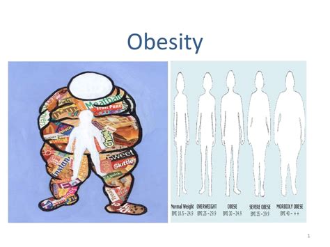 PPT Obesity PowerPoint Presentation Free Download ID