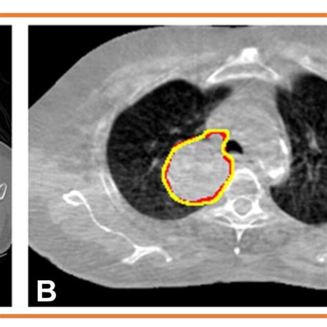 Segmentations Produced By Cross Modality Distillation Learning Applied Download Scientific