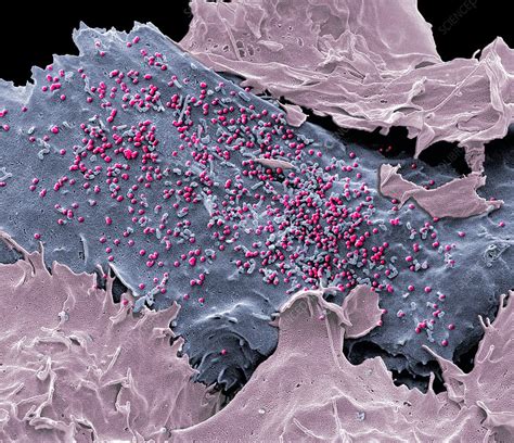 Hiv Infected Cell Sem Stock Image C038 1156 Science Photo Library