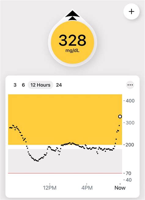 Super Hypo One Time And The Endo Gets Scared R Dexcom