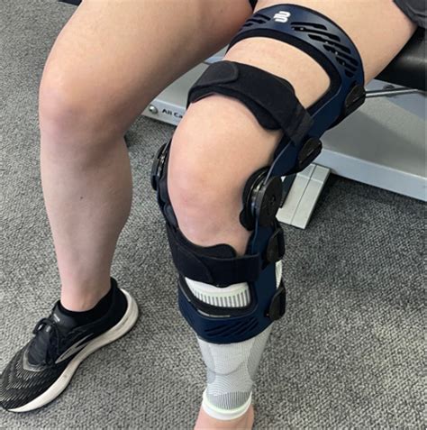 Practical Tips For Cross Bracing Protocol Heal ACL