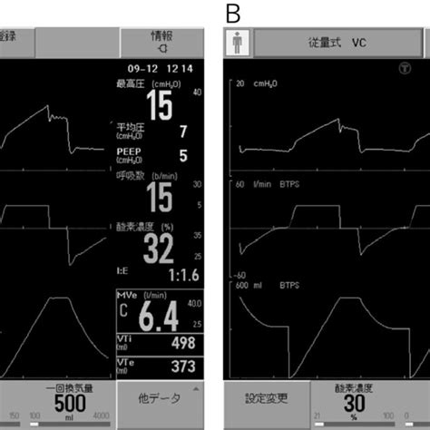 Graphical Examples Of Patient Ventilator Asynchrony Airway Pressure Download Scientific