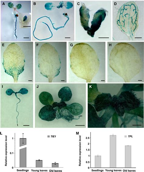 Figure 3 From The Tie1 Transcriptional Repressor Links Tcp Transcription Factors With Topless